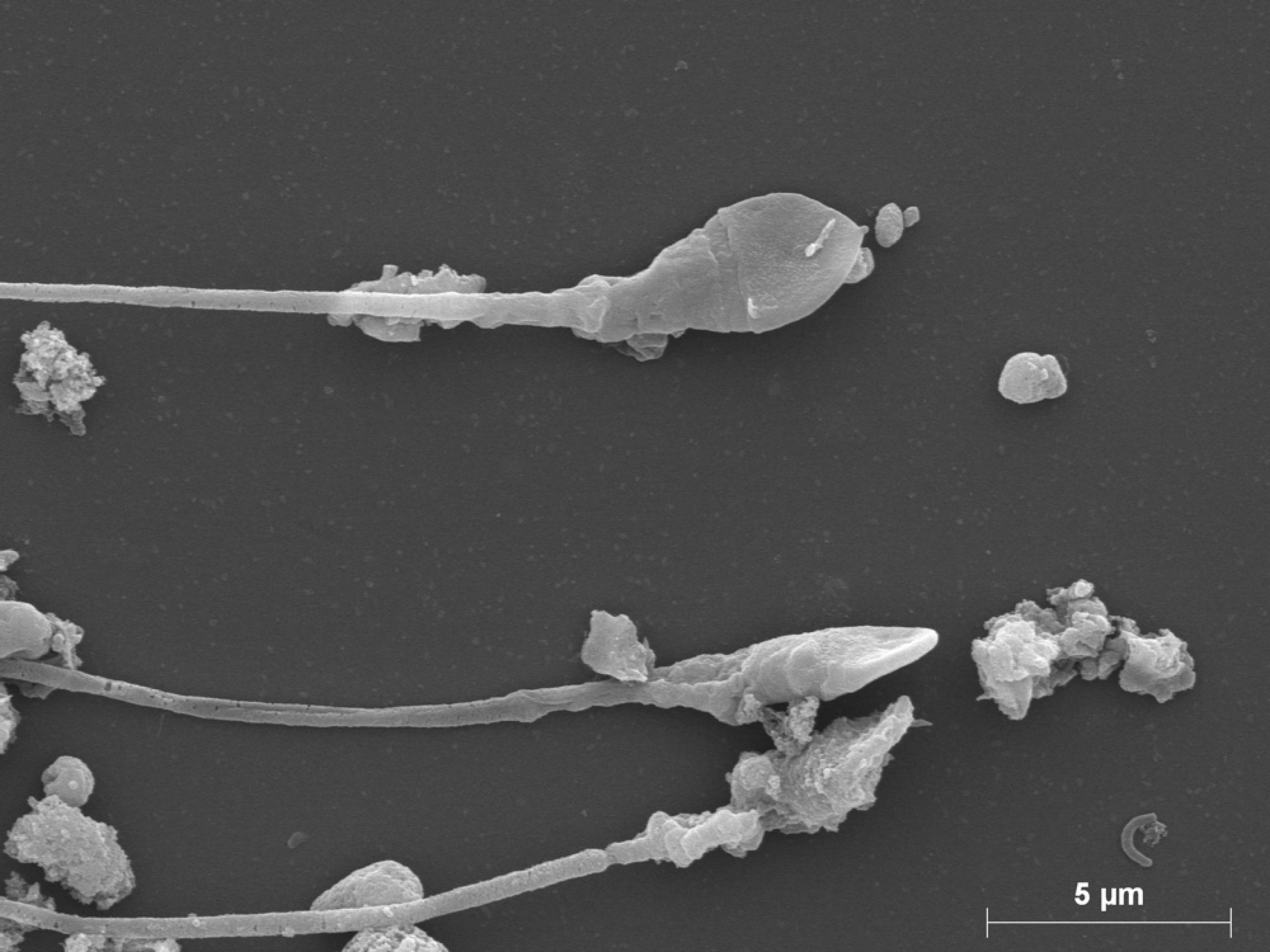 Sperm Analysis Technologies - Home